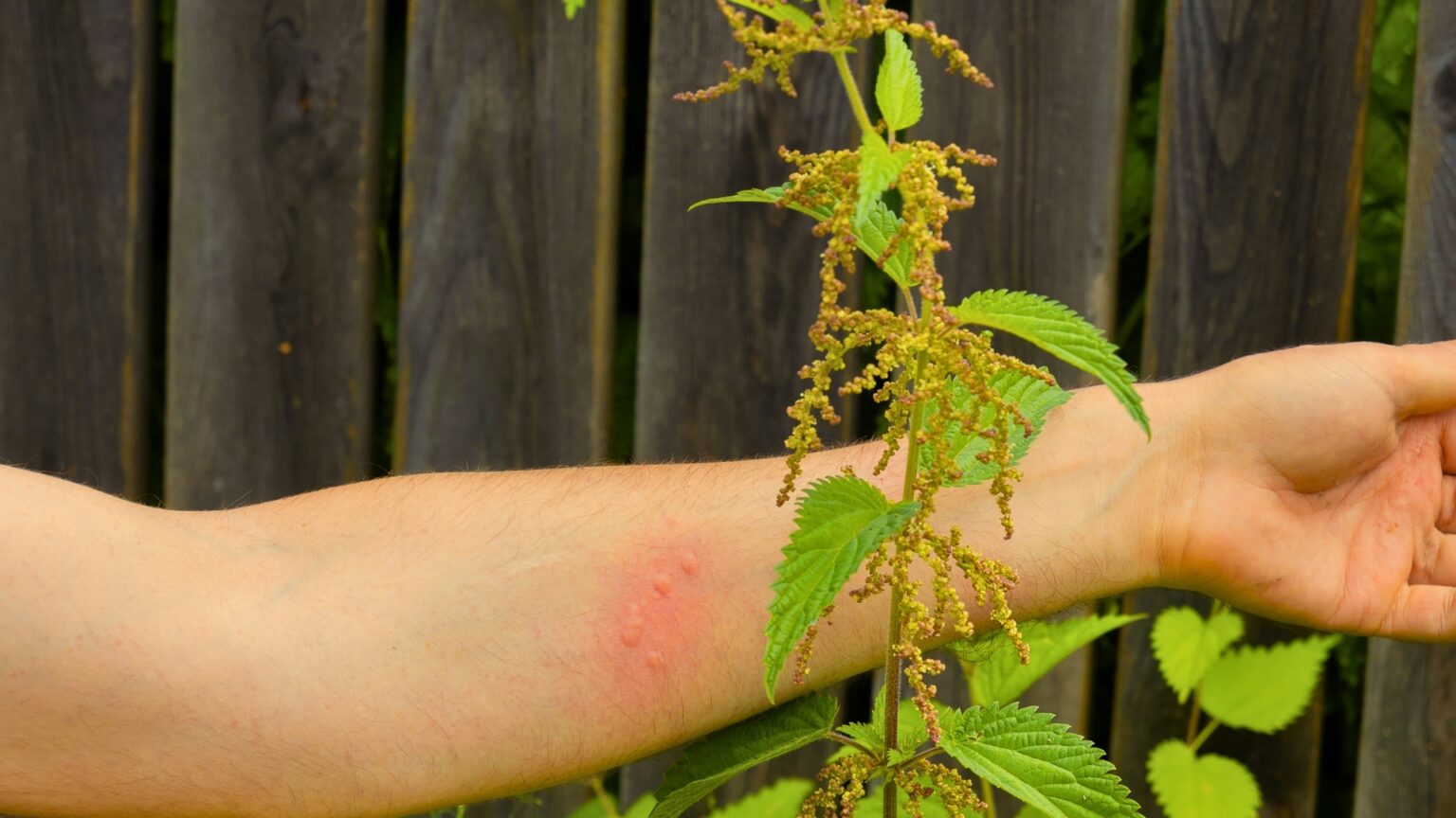 16 Plants That May Cause Skin Irritation In Your Garden